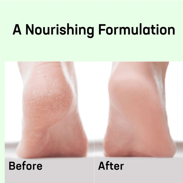 White Leaf Froot Cream Cracked Heel Repair Cream For Winter ...